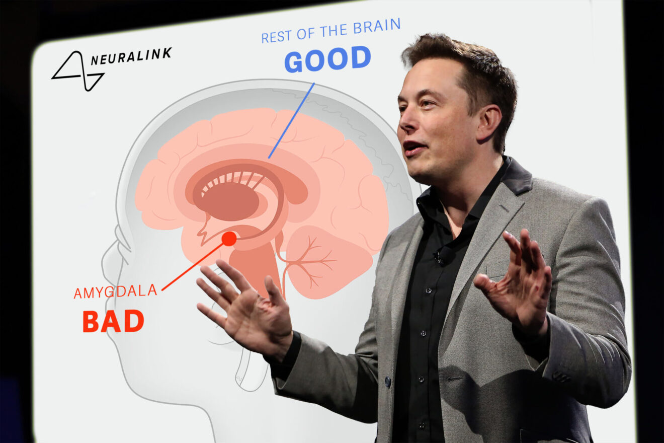 Neuralink Announces Amygdala Removal Surgery – The MQ